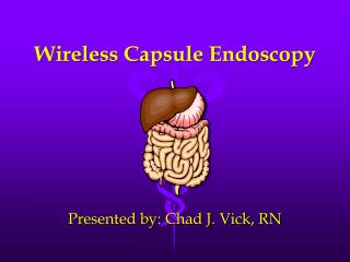 PPT - Wireless Capsule Endoscopy PowerPoint Presentation, free download ...