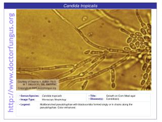 PPT - Candida tropicalis PowerPoint Presentation, free download - ID ...