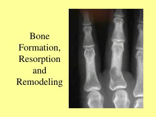 PPT - Bone Formation, Resorption and Remodeling PowerPoint Presentation ...