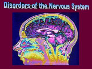 PPT - Disorders of the Nervous System PowerPoint Presentation, free ...