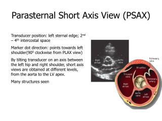 PPT - Parasternal Short Axis View (PSAX) PowerPoint Presentation, free ...