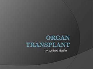 PPT - Organ Transplant PowerPoint Presentation, free download - ID:2164007