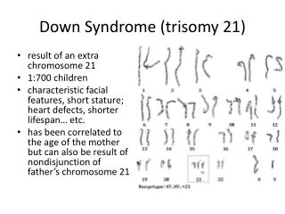 PPT - Trisomy 21: Down Syndrome PowerPoint Presentation - ID:2171104