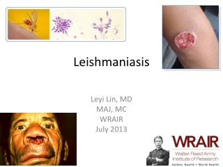 PPT - Leishmania donovani PowerPoint Presentation - ID:6200634