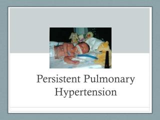 PPT - Persistent Pulmonary Hypertension of the Newborn (PPHN ...