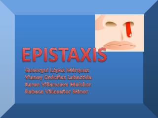 PPT - EPISTAXIS PowerPoint Presentation, free download - ID:2195942