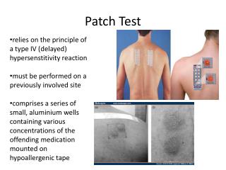 PPT - Patch Test PowerPoint Presentation, free download - ID:2244373