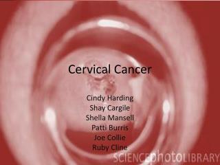 PPT - Cervical Cancer PowerPoint Presentation, free download - ID:2361602