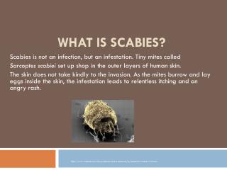 PPT - What Is Scabies? PowerPoint Presentation, free download - ID:2457230