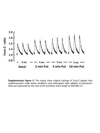 Bilateral basal crepitations PowerPoint (PPT) Presentations, Bilateral ...