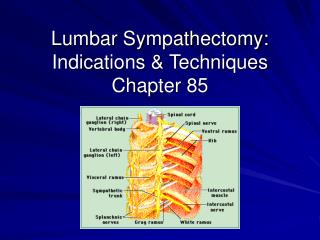 PPT - Lumbar Sympathectomy: Indications & Techniques Chapter 85 ...