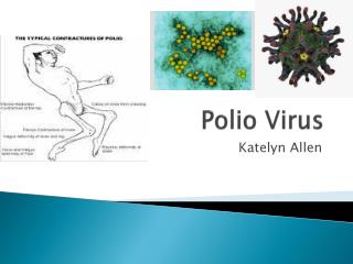 PPT - Polio Virus PowerPoint Presentation, free download - ID:2675702