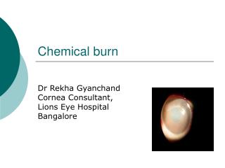 PPT - DISEASES OF CORNEA PowerPoint Presentation - ID:793553