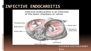 PPT - Infective Endocarditis PowerPoint Presentation, free download ...