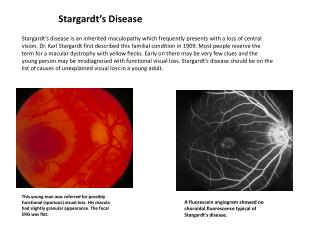 PPT - Stargardt’s Disease PowerPoint Presentation, free download - ID ...