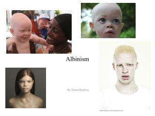 PPT - Albinism A Genetic Disorder PowerPoint Presentation - ID:2380425
