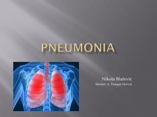PPT - PNEUMONIA PowerPoint Presentation, free download - ID:2911439