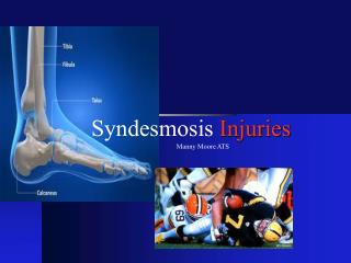 PPT - Syndesmosis Injuries PowerPoint Presentation, free download - ID ...