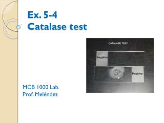PPT - Ex. 5-4 Catalase test PowerPoint Presentation, free download - ID ...