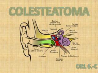 PPT - COLESTEATOMA PowerPoint Presentation - ID:2582366