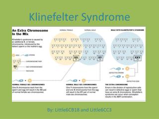 PPT - Klinefelter’s Syndrome PowerPoint Presentation - ID:963511