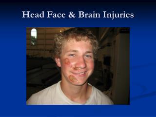 PPT - Head Face & Brain Injuries PowerPoint Presentation, free download ...