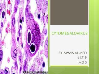 PPT - Cytomegalovirus infection: Owl’s eye nuclear inclusion bodies ...