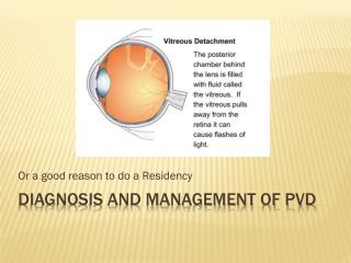 PPT - Diagnosis and management of PVD PowerPoint Presentation, free ...