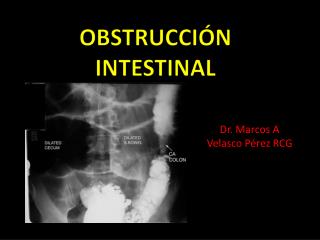 PPT - OBSTRUCCIÓN INTESTINAL PowerPoint Presentation, free download ...