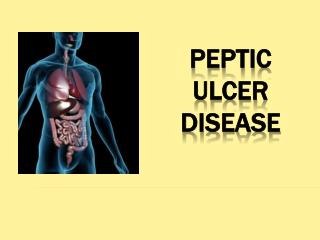 PPT - Peptic Ulcer Disease PowerPoint Presentation, free download - ID ...