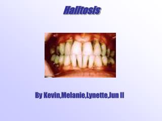 PPT - Halitosis PowerPoint Presentation, free download - ID:369592