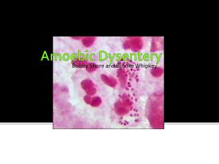 PPT - Amoebic Dysentery PowerPoint Presentation, free download - ID:4363751