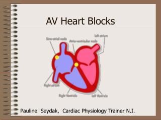 PPT - AV Heart Blocks PowerPoint Presentation, free download - ID:720555