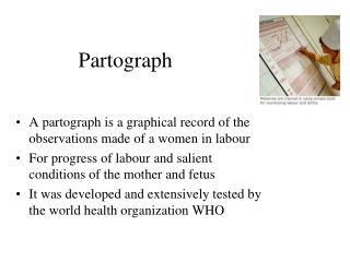 PPT - Partograph PowerPoint Presentation, free download - ID:742543