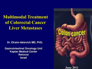 PPT - Colon cancer PowerPoint Presentation, free download - ID:845915