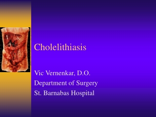 PPT - Cholelithiasis PowerPoint Presentation, free download - ID:9554067
