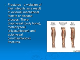 PPT - Changes in the joint during prolonged immobilization PowerPoint ...
